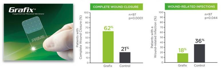 Grafix and Therapeutic Value of Placental Tissues: Please, Do Not Discard!